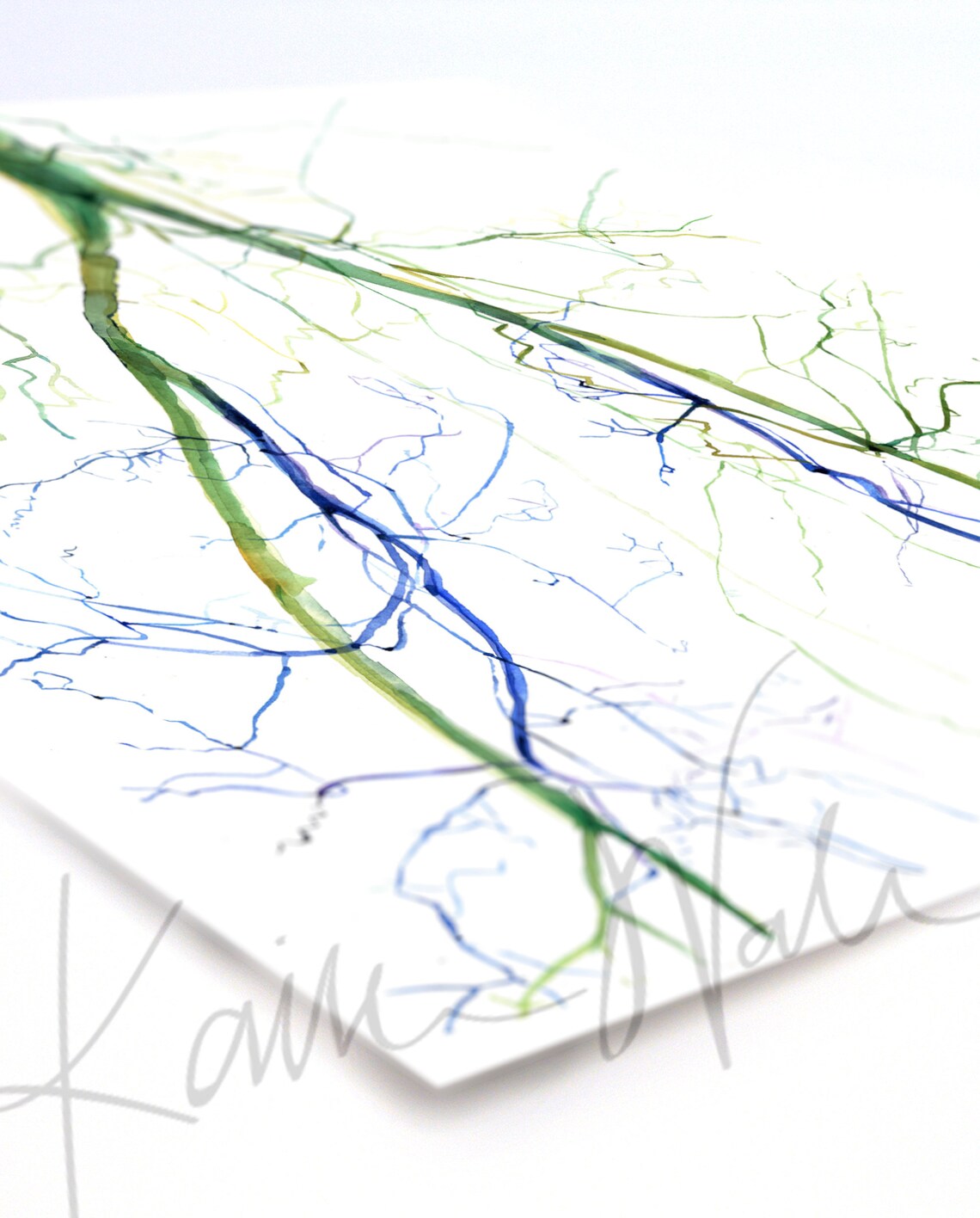 Combined Angiogram Watercolor Print Cardiology Art Gift - Etsy