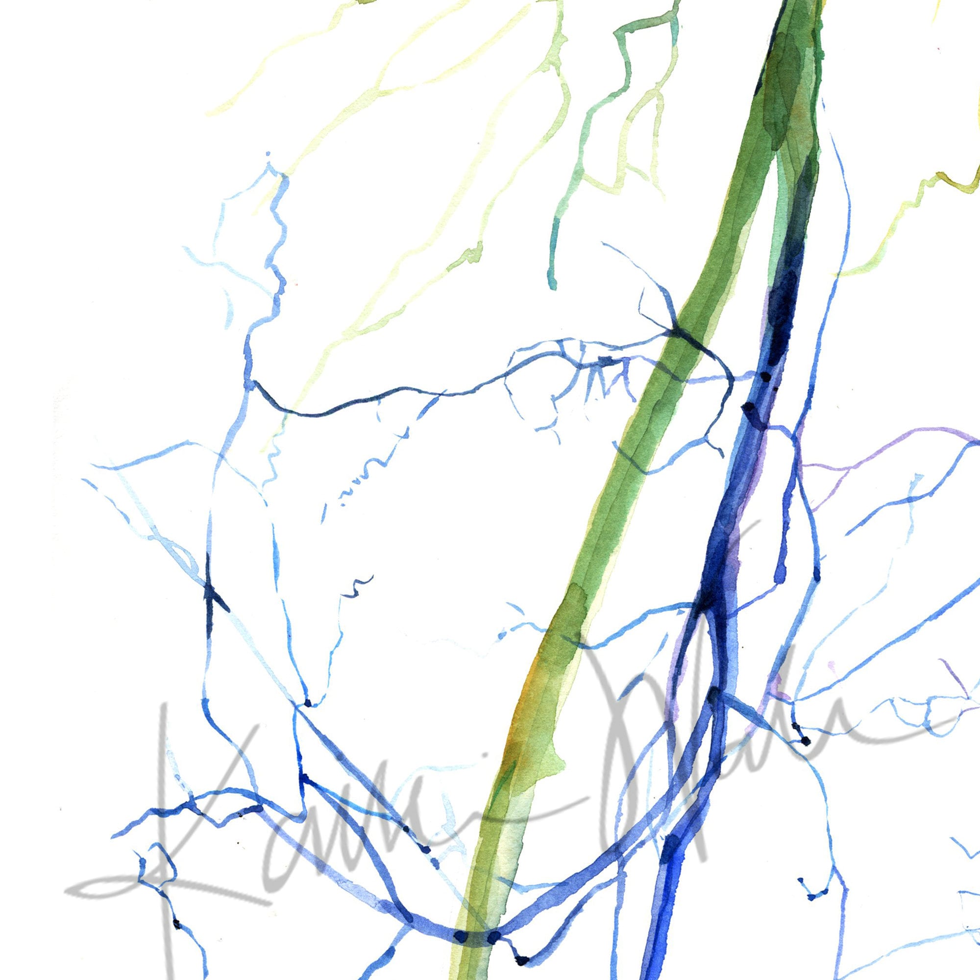 Combined Angiogram Watercolor Print Cardiology Art Gift | Etsy