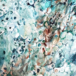 Skin Histology Watercolor Print Set - Skin Art - Dermatology Art - Gift ...