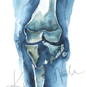 Knee Repair Watercolor Print Set - Orthopedics Print - Orthopedic ...