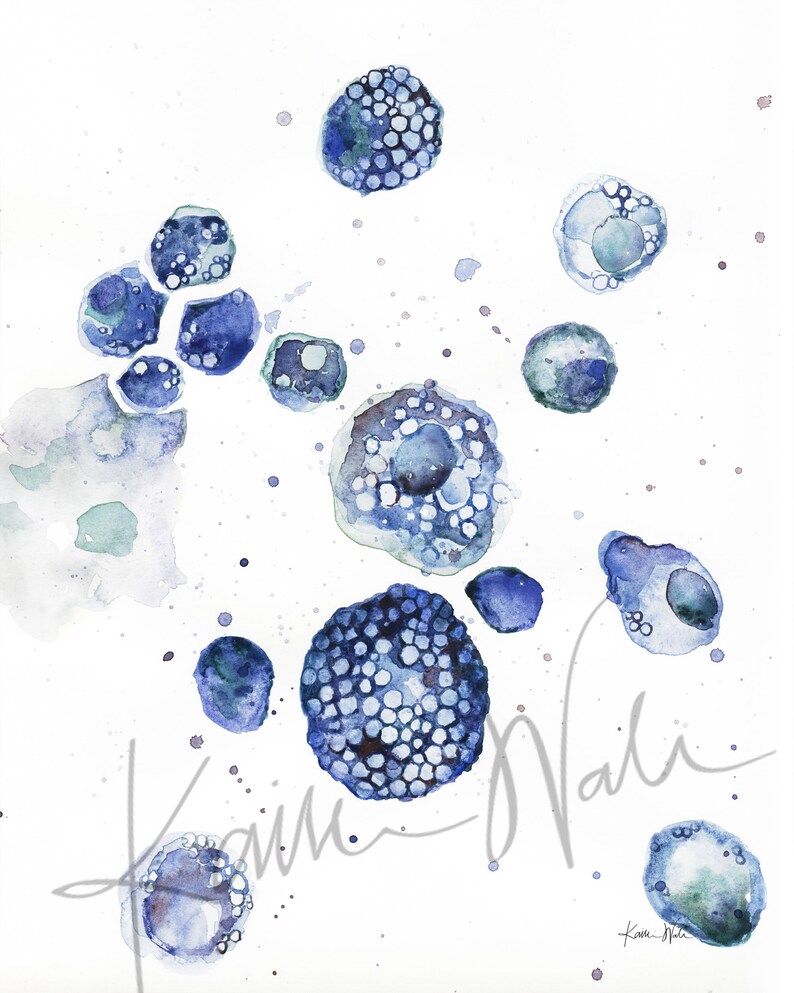 Mott Cells Watercolor Print - Histology Art - Russell Bodies Painting ...