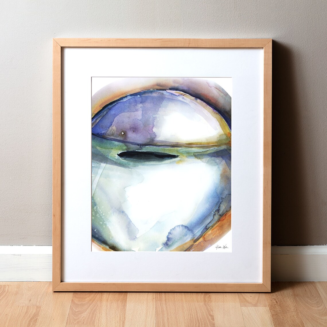 Bulging Cornea Watercolor Print - Keratoconus - Optometry Art - Etsy