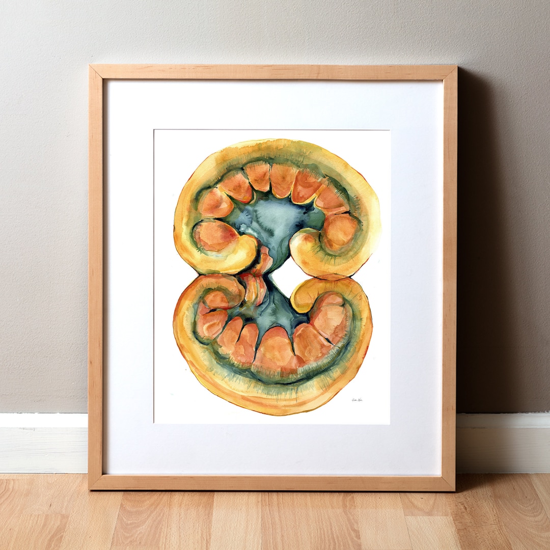 Exquisite Kidney Watercolor Print - Nephrology Art - Kidney Painting ...