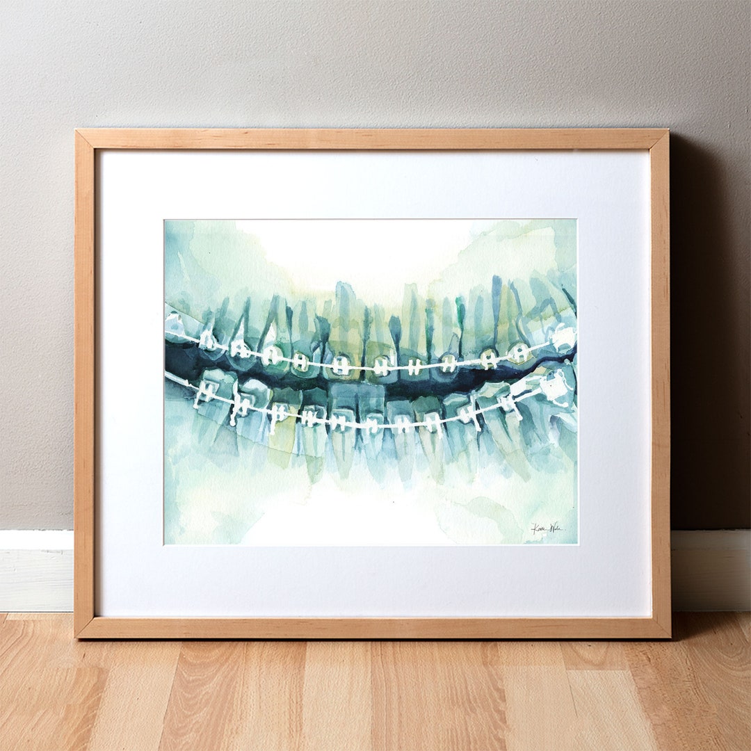 Braces Watercolor Print Unframed - Braces Art - Teeth Art - Dental Art ...