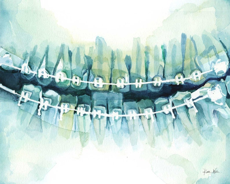 Braces Watercolor Print Unframed - Braces Art - Teeth Art - Dental Art ...