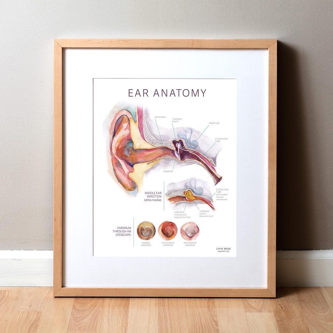 Ear Anatomy Poster - Middle Ear Infection Diagram Art - ENT Decor ...