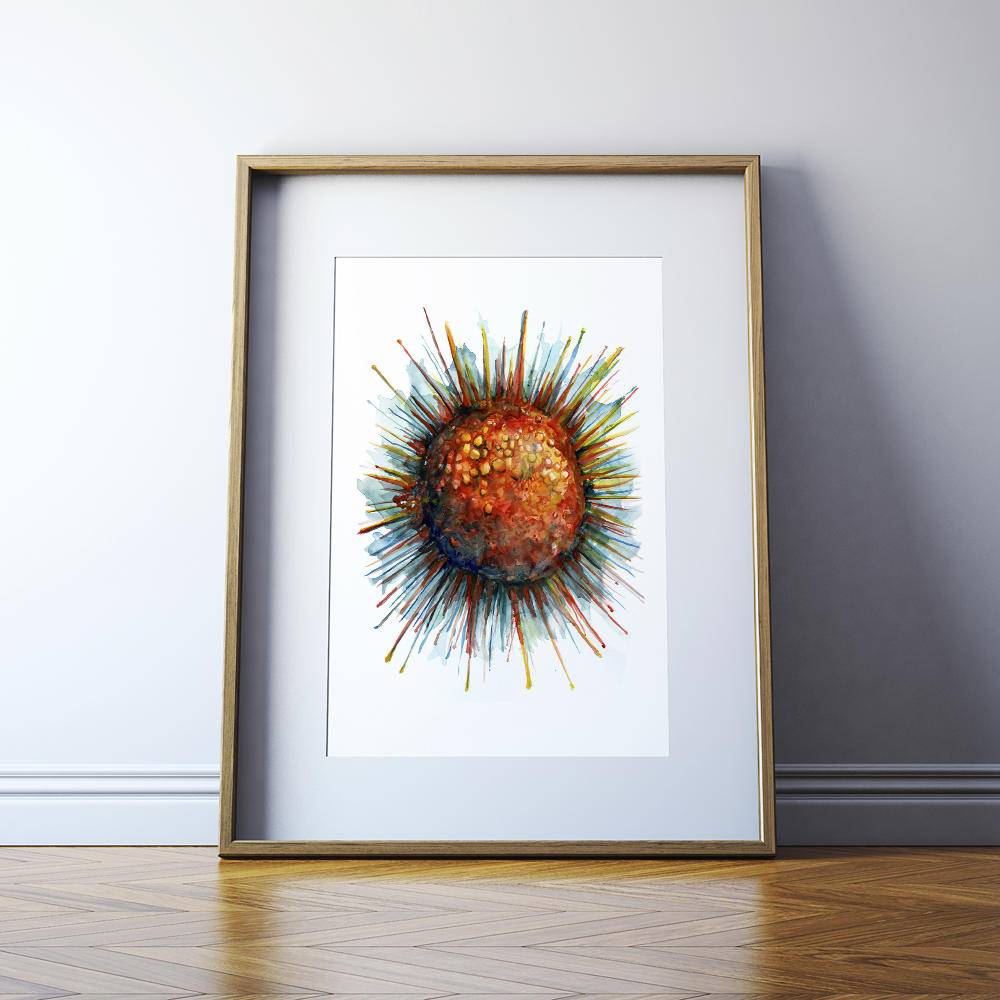 Cancer Cell Watercolor Art Print Histology Art Print - Etsy