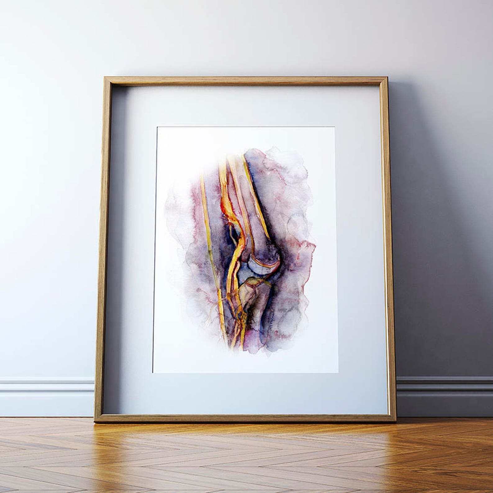 Deep Vein Thrombosis Watercolor Art Print Cardiovascular - Etsy