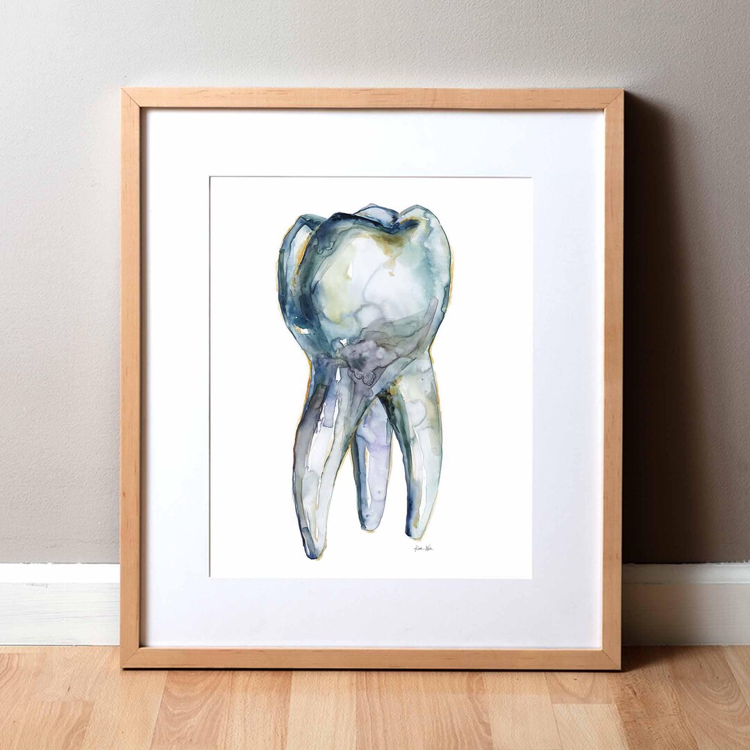 View of Occlusal Molar Watercolor Print - Abstract Dental Anatomy Art ...