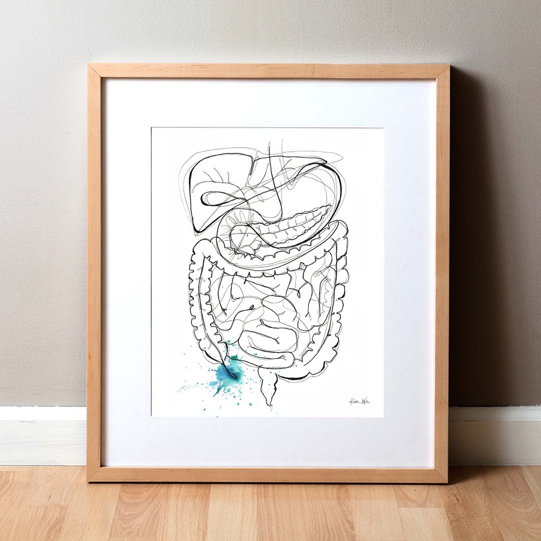 Appendicitis Watercolor Print - GI Anatomy Art - Gastrointestinal ...