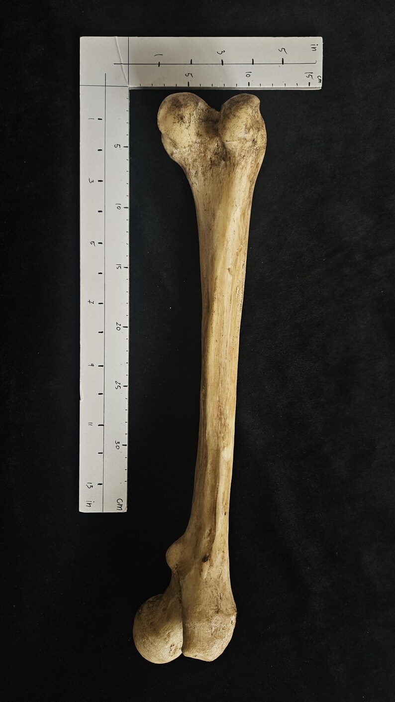 Artificial Human Bones, Moulded From Real Bones, Casted Bones, Fake ...