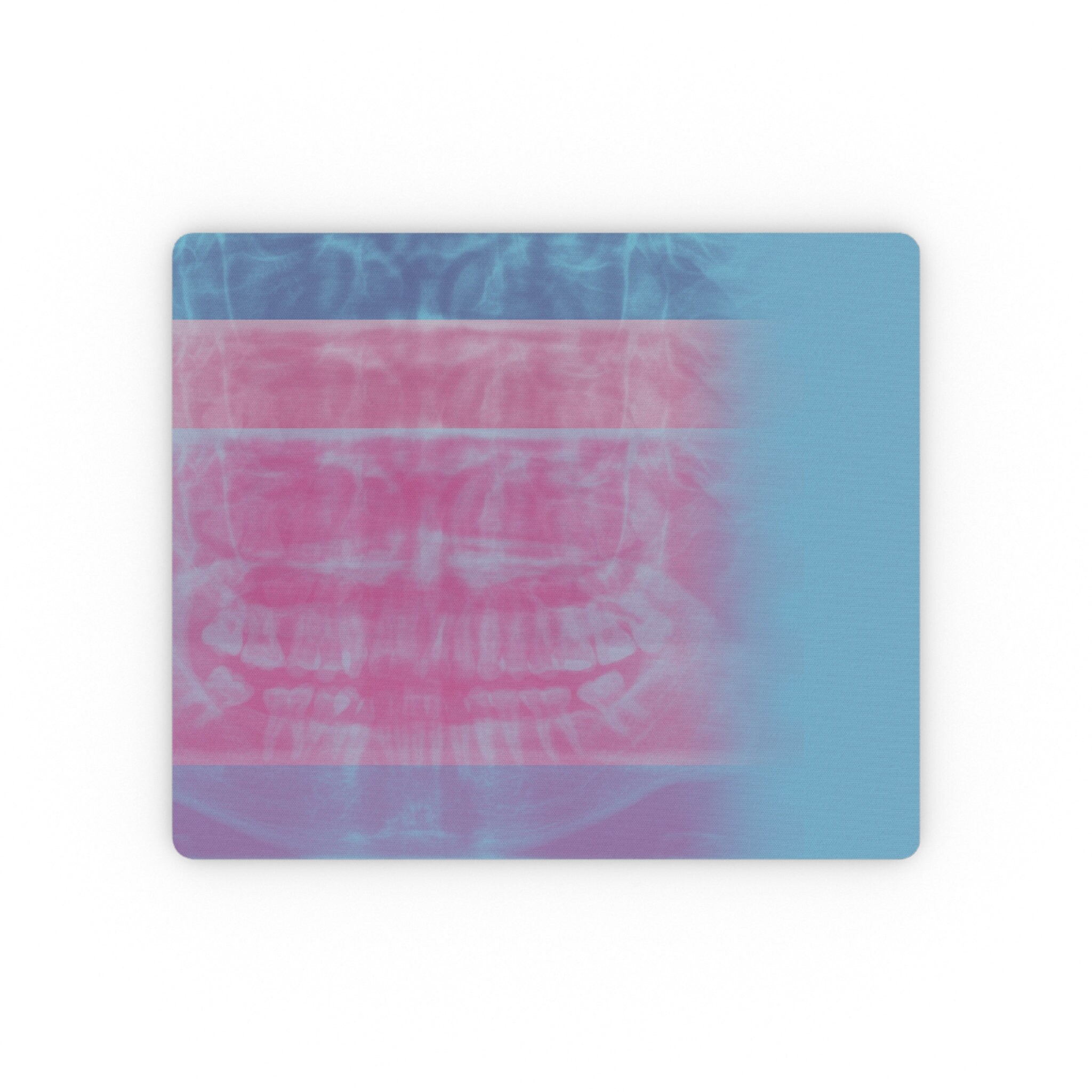 Dental Xray Mouse Pad, Radiograph Tooth, Dentist Gift, Dental Assistant ...