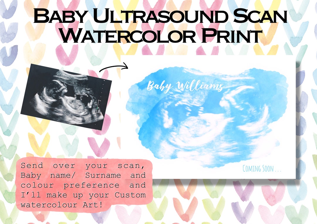 Watercolour Ultrasound or Sonogram Art, Baby Scan Print, Card, Keepsake ...