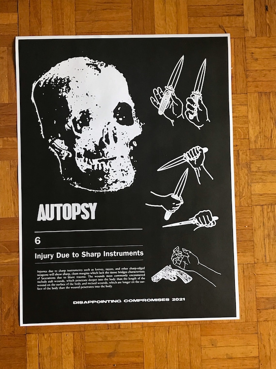 Autopsy Poster 24x36 - Etsy