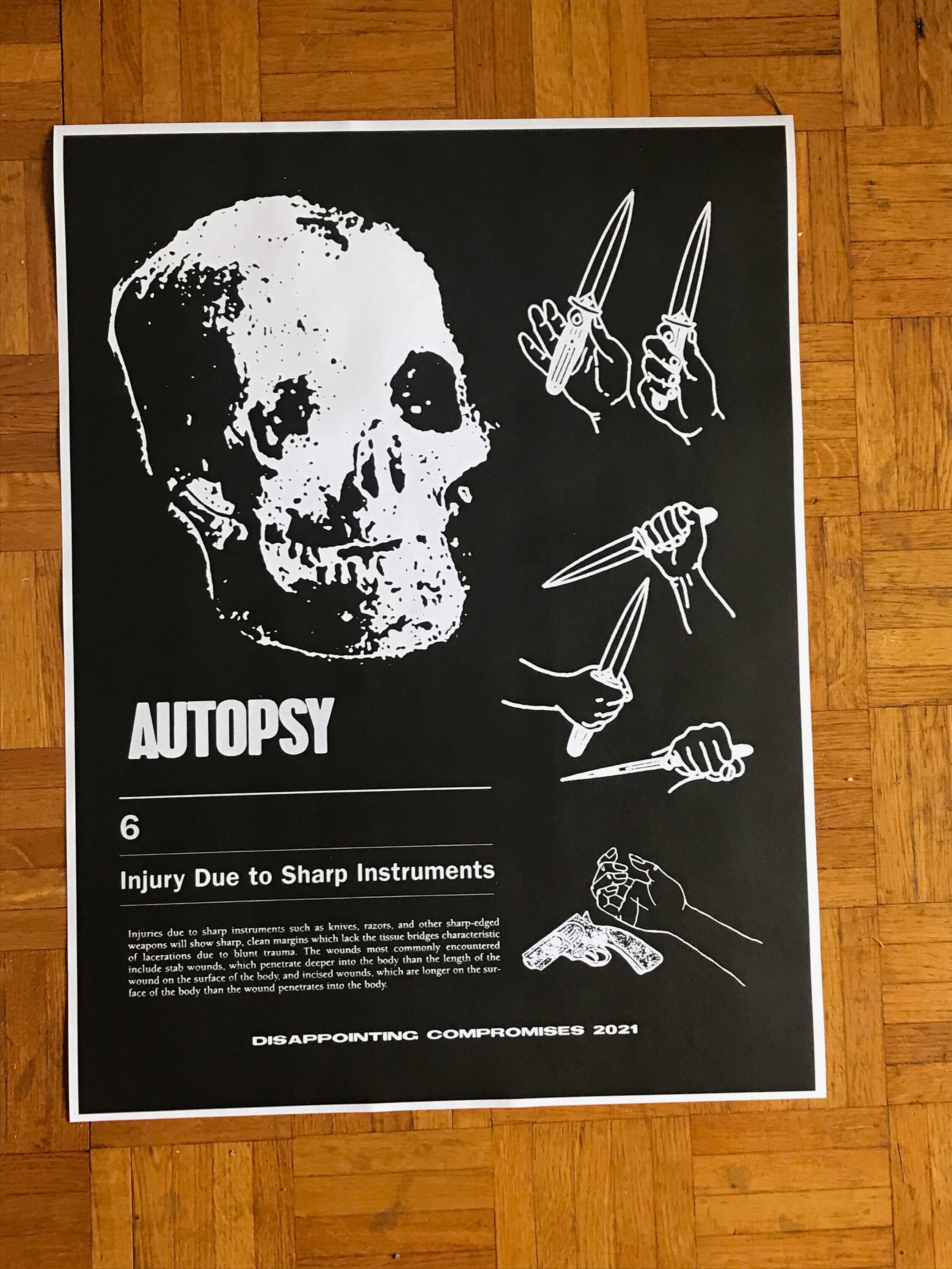 Autopsy Poster 24"x36" - Etsy