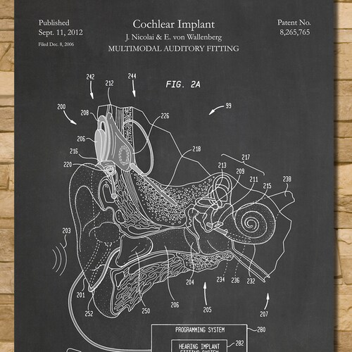 Anatomy Art Ear Implant Print Audiology Poster Cochlear - Etsy