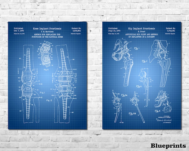 Knee and Hip Implant Patent Art Set of 2 | Etsy