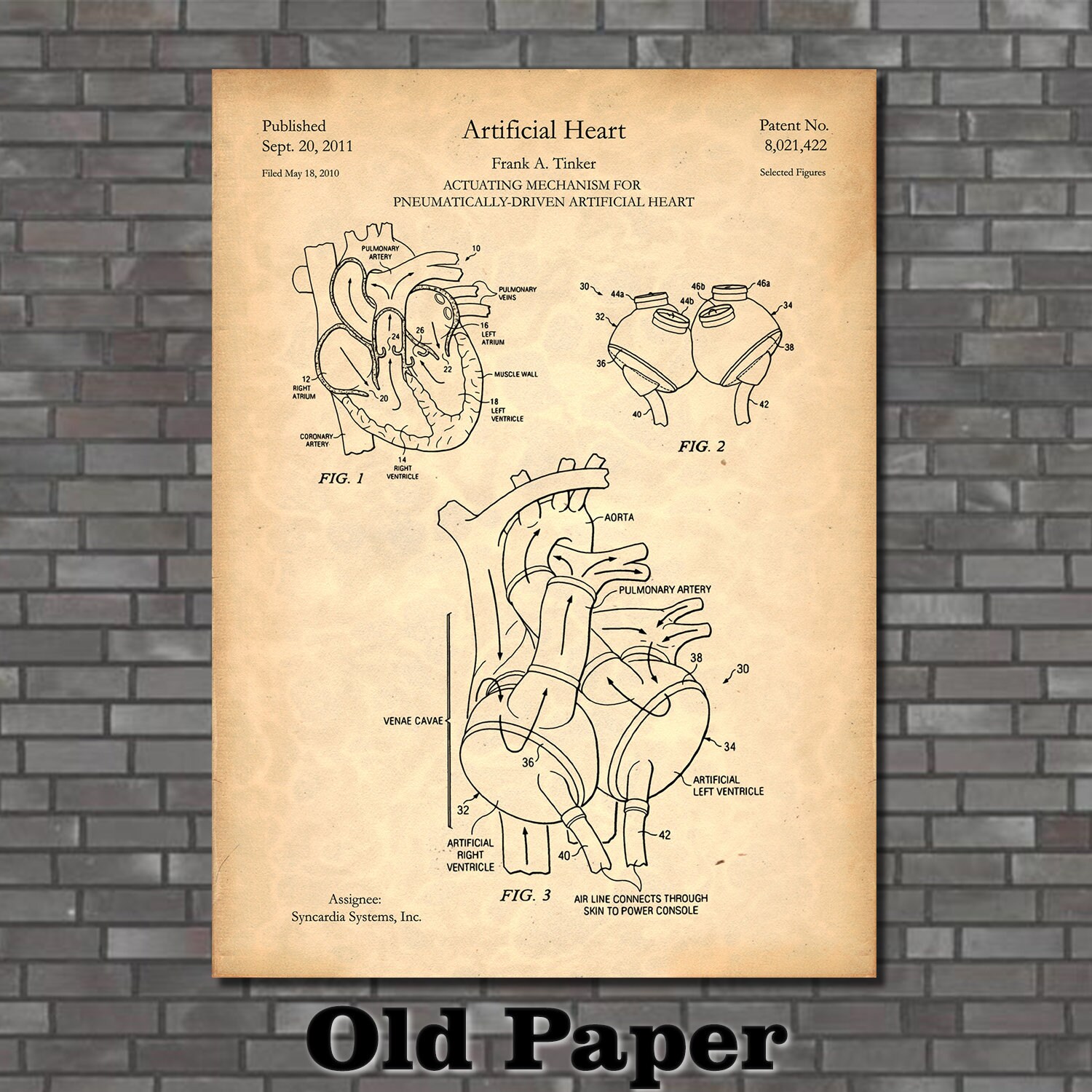 Artificial Heart Patent Print Art 2011 - Etsy