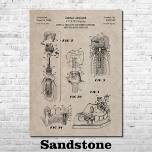 Dental Implant Patent Print Art 1996 - Etsy