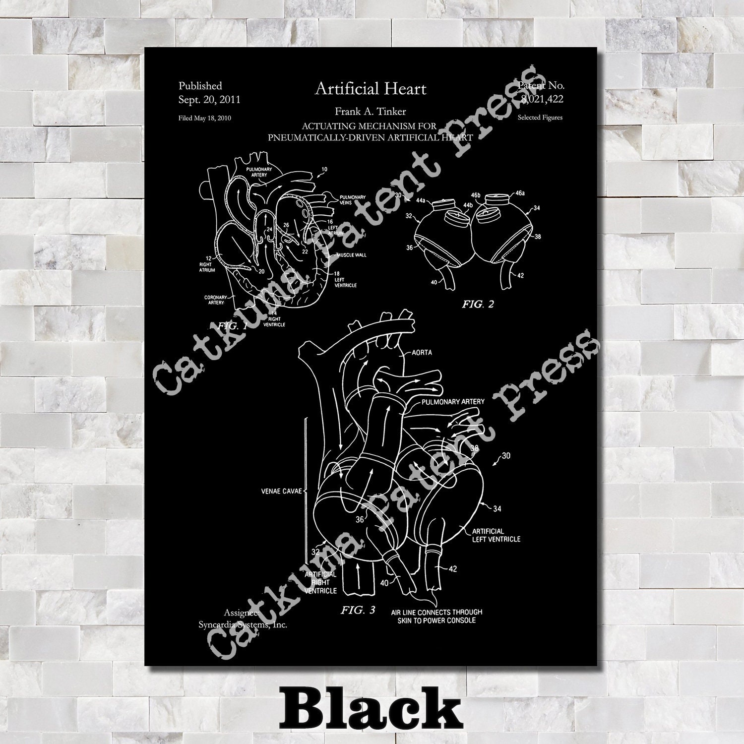 Artificial Heart Patent Print Art 2011 - Etsy