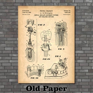 Dental Implant Patent Print Art 1996 - Etsy