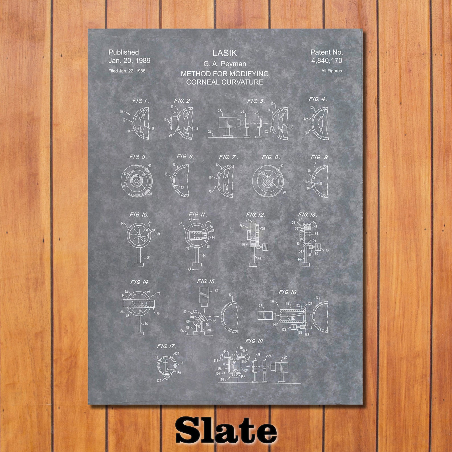 LASIK Laser Eye Surgery Patent Print Art 1989 - Etsy