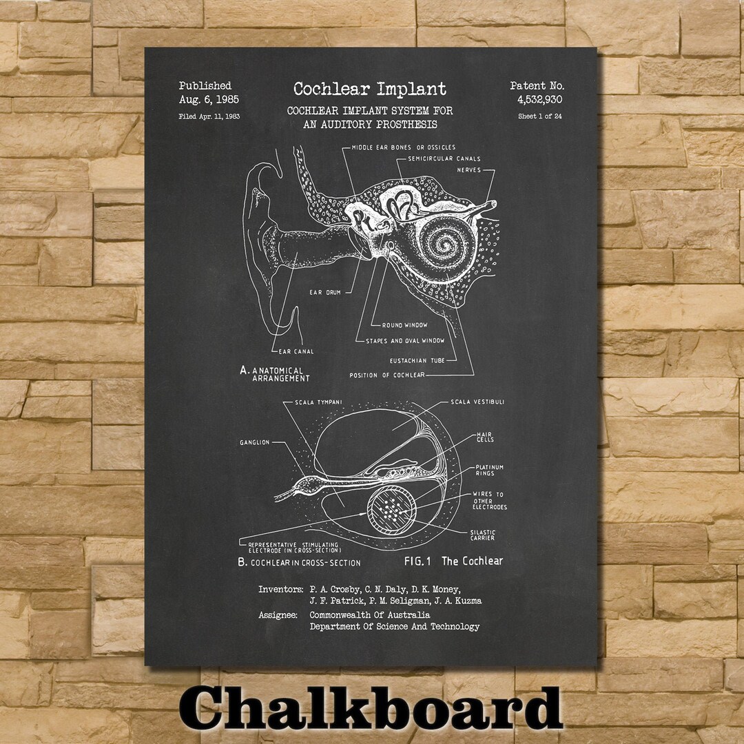 Cochlear Implant Patent Print Art 1985 - Etsy