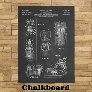 Dental Implant Patent Print Art 1996 - Etsy