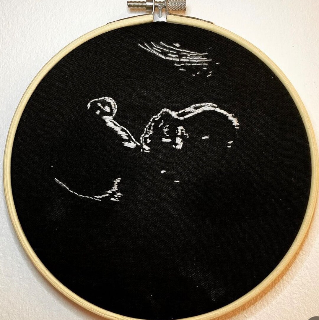 Custom Ultrasound Embroidery Art - Etsy