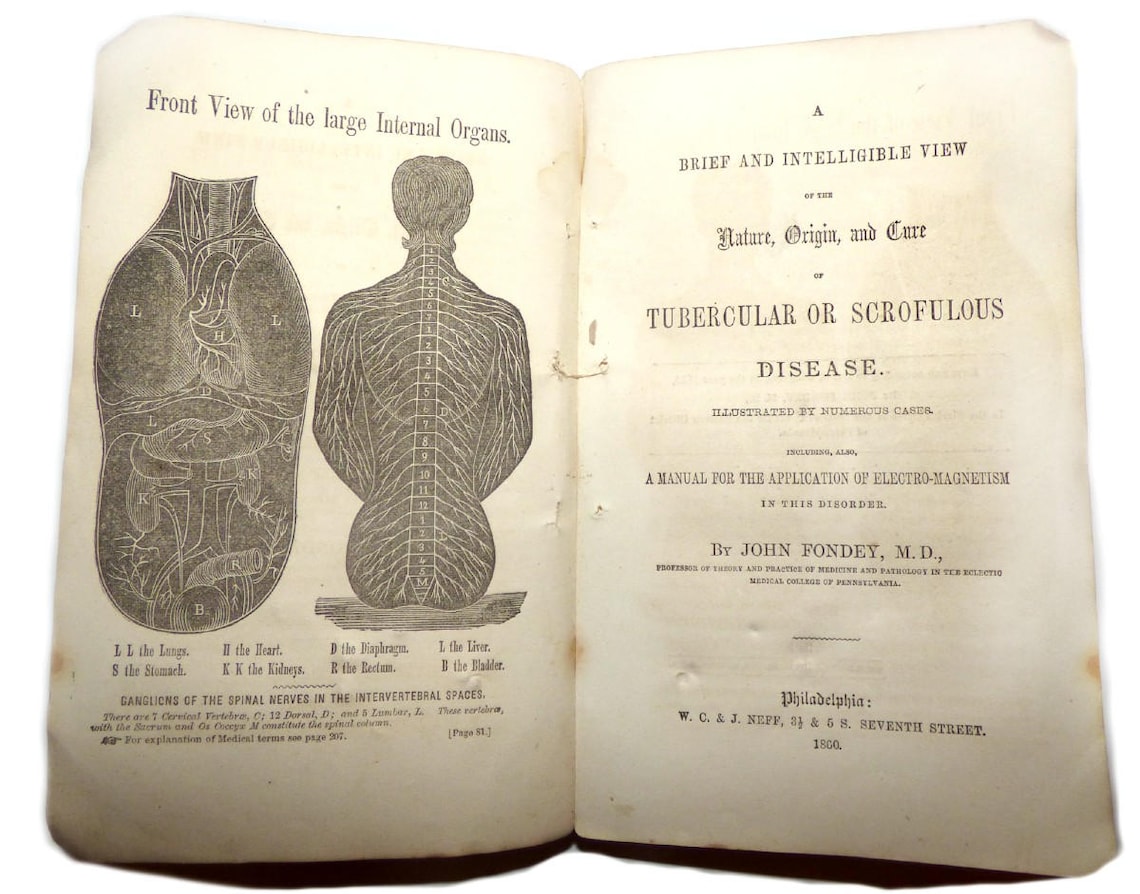 1860 Civil War Medical Book on the Nature Origin and Cure of - Etsy