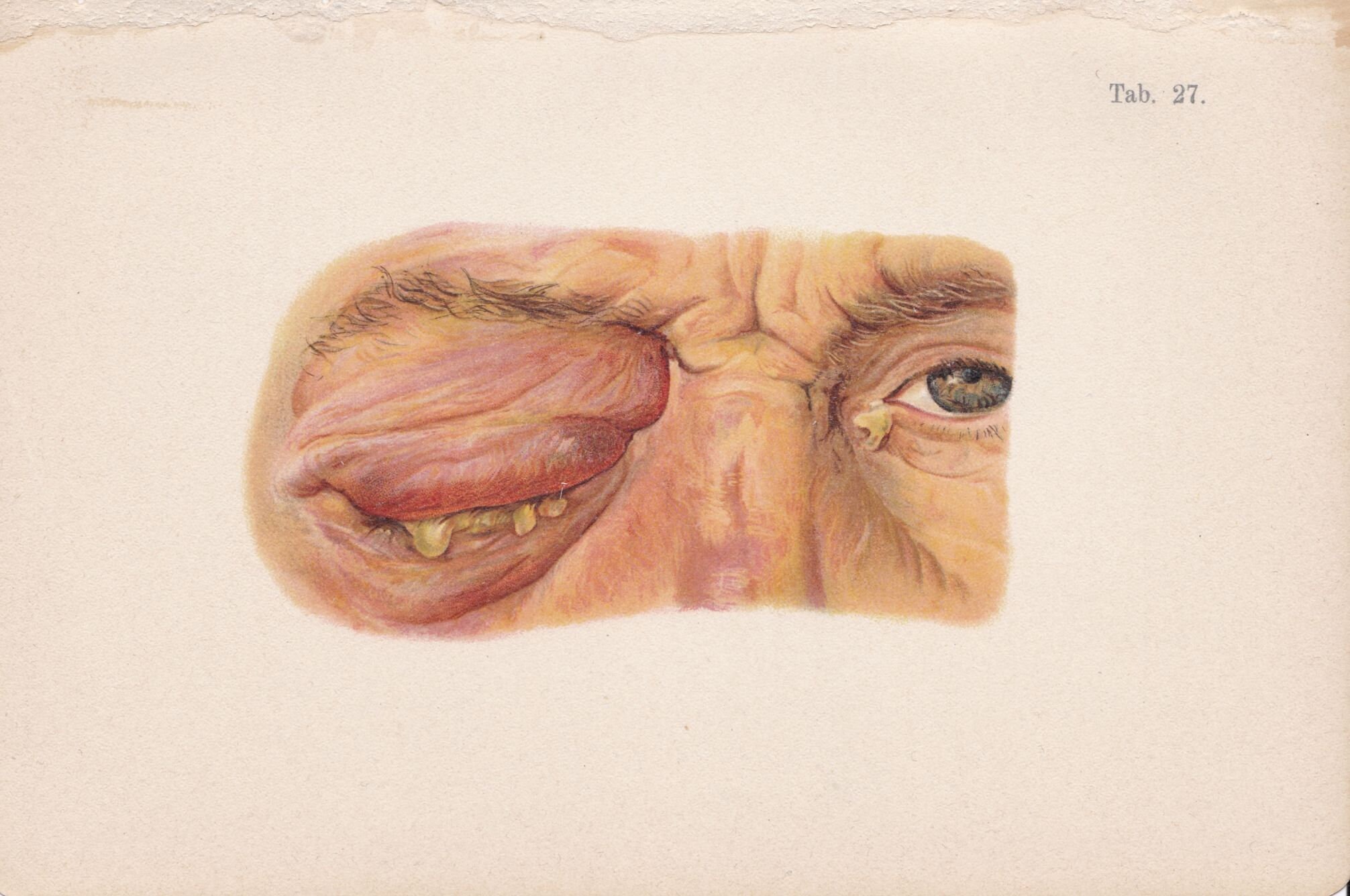 Original Antique Eye Disease Infection Remedy Diagnosis Doctor Medical ...