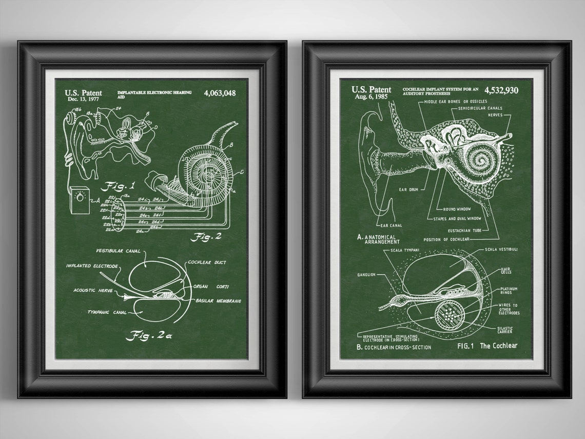 Cochlear Patent Human Anatomy Poster Audiologist Gift for | Etsy
