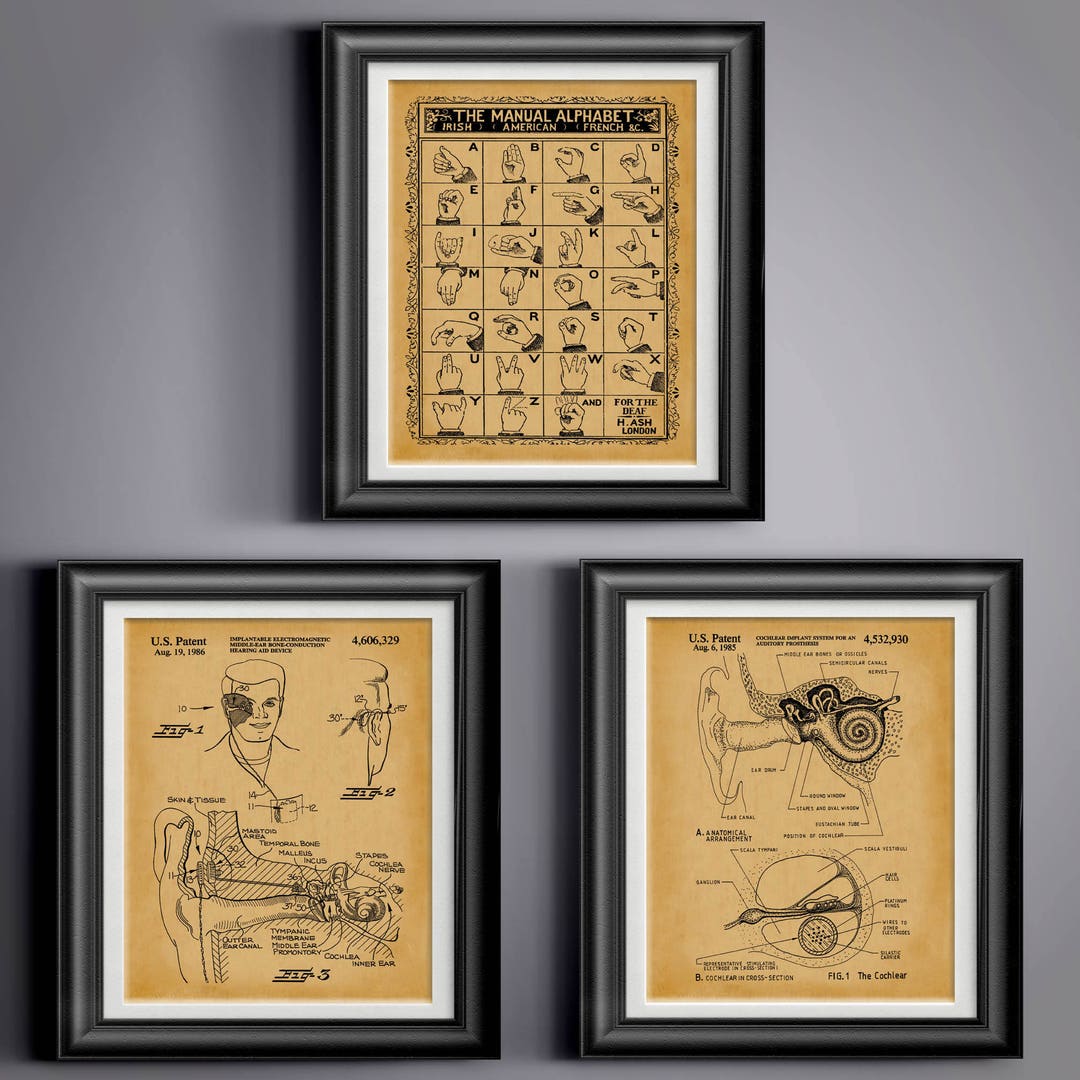 Audiologist Gift: Sign Language Print Set, Cochlear Patent Art ...