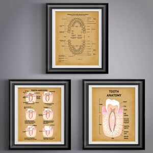 Dentist Gift Print Dental Office Decor Dental Dentist Art Posters ...