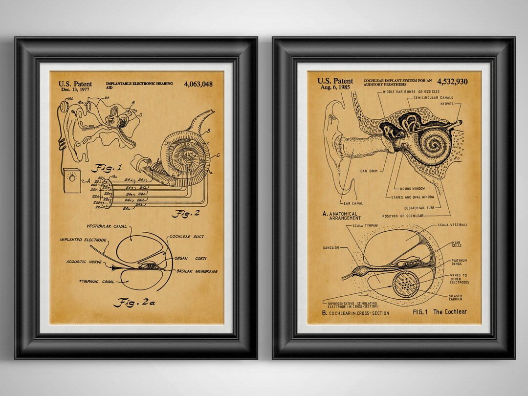 Cochlear Patent Human Anatomy Poster Audiologist Gift for Audiologist ...