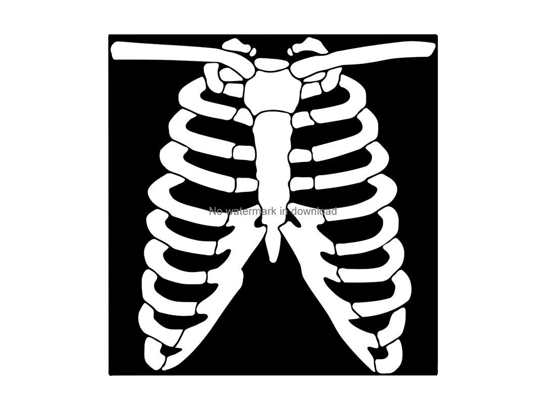Chest X-ray SVG Clipart: T-shirt Design Vector (digital Download) - Etsy