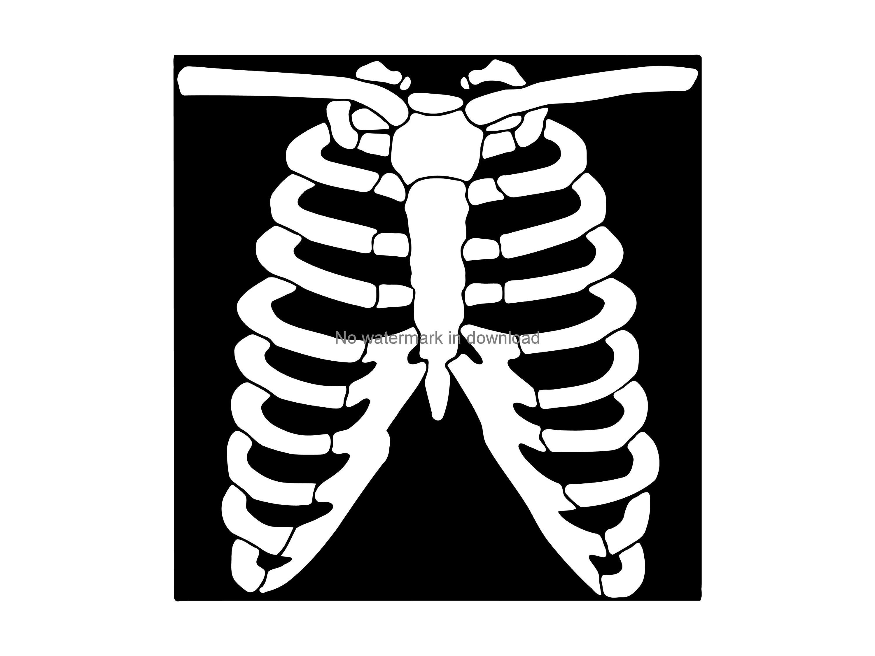 Chest X Ray Clipart