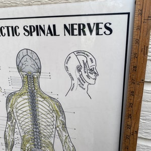 Chiropractic Spinal Nerve Chart/vintage Medical Chart Copyright 1952 ...