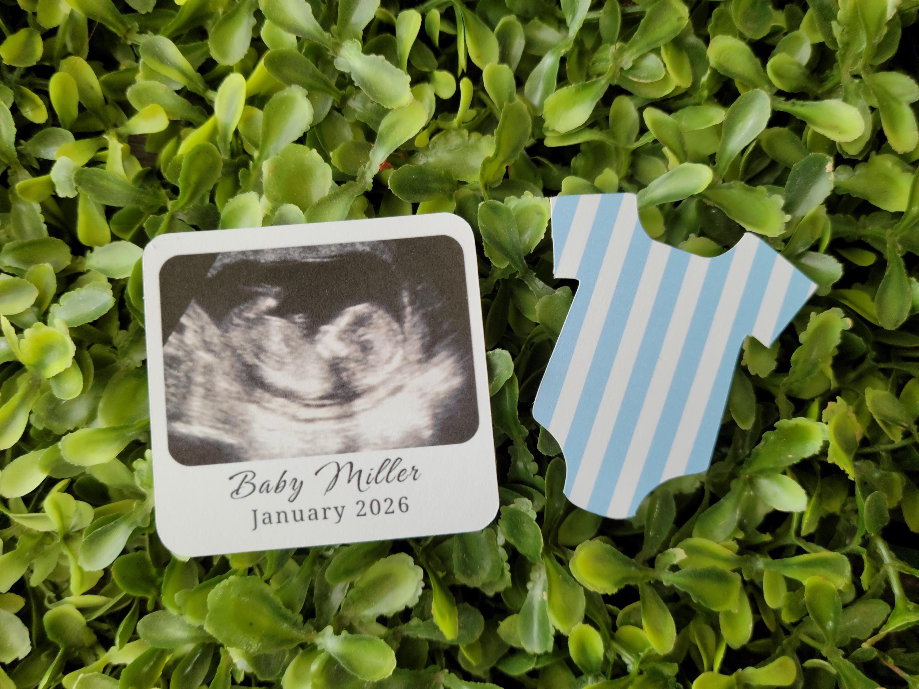 Baby Ultrasound Confetti | Custom Baby Shower Table Decorations ...