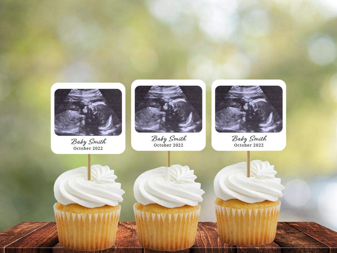 Baby Ultrasound Cupcake Toppers | Custom Personalized Decorations ...