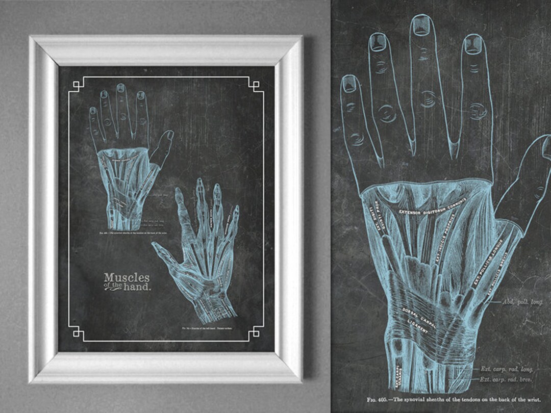 Hand and Wrist Anatomy Poster for Massage, Surgeon, Physical Therapist ...