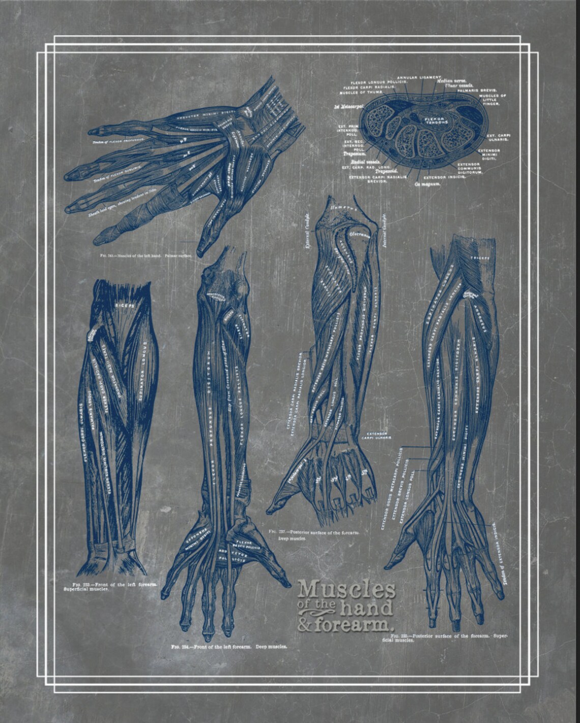 Arm and Hand Muscles Anatomy Navy Blue // Print at Home // | Etsy