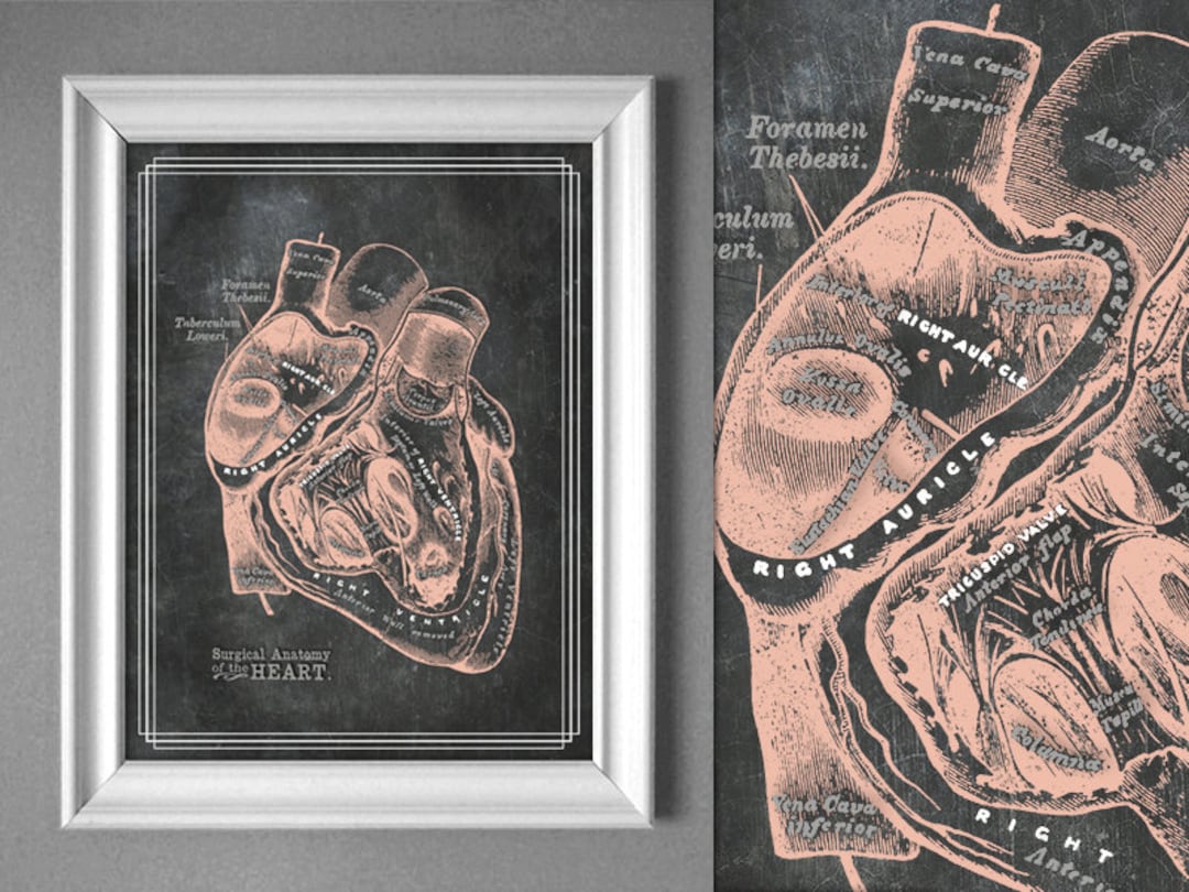Surgical Heart Anatomy Cardiac Surgeon Doctor Art Medical Office Gym ...