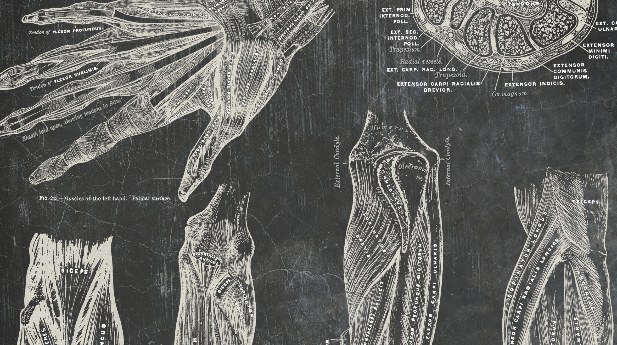 Hand & Forearm Muscles Anatomy Art: Gray's Anatomy Print (digital ...