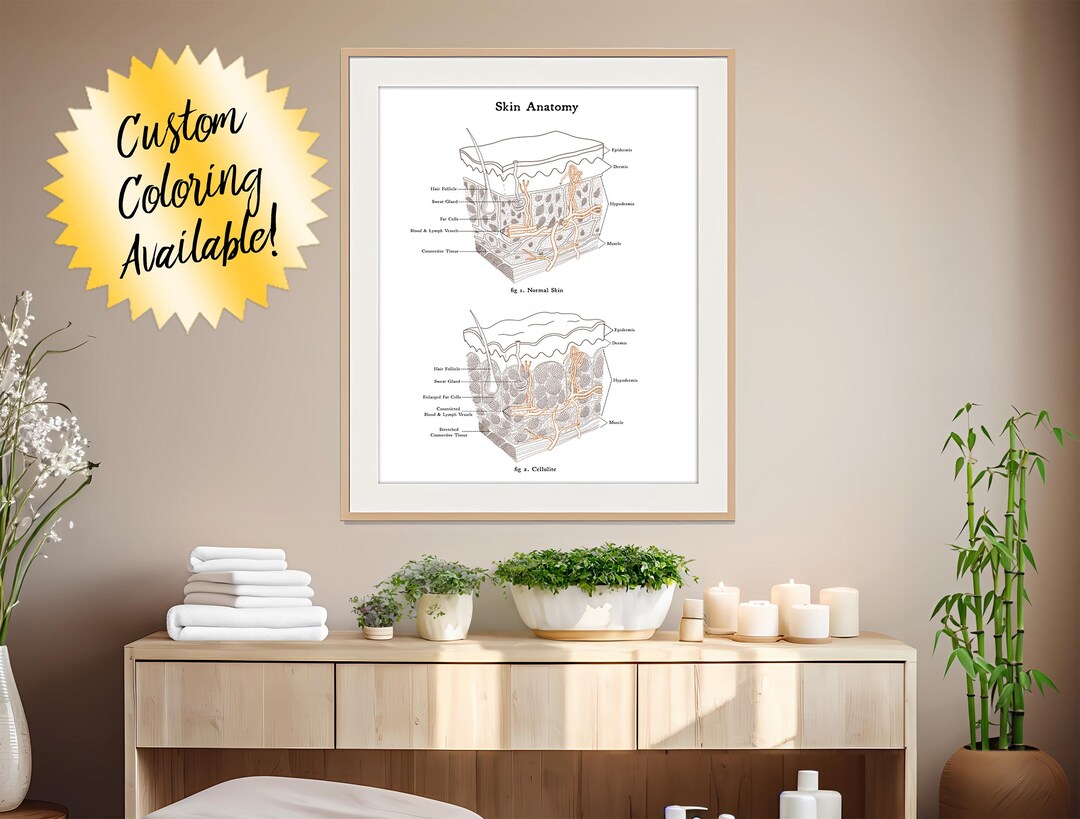 Cellulite Vs Healthy Skin Anatomy Poster for Lymphatic Drainage Massage ...