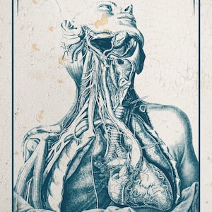 Human Dissection Vintage Anatomy Art Custom Color 8x10 16x20 - Etsy