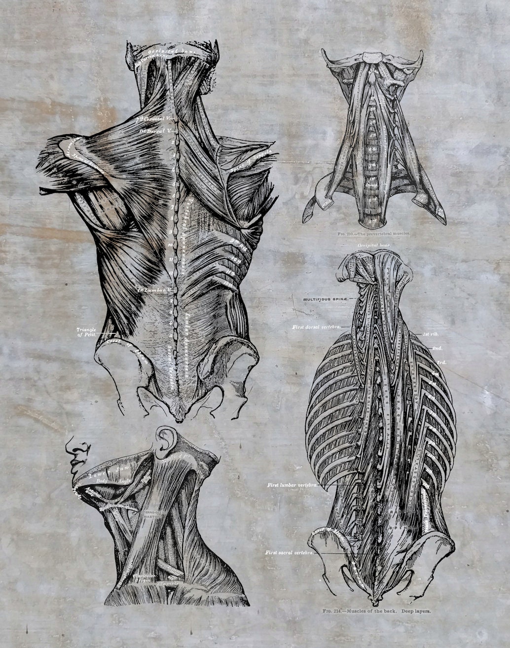 Back and Neck Muscles Print // DIY // 11x14 // Black Grey | Etsy