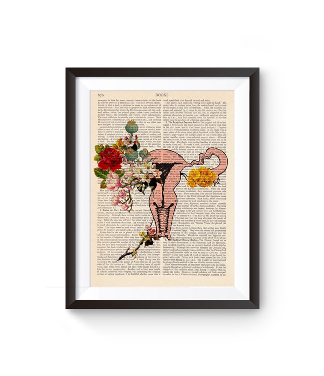 Uterus Print, Female Reproductive System, Pregnancy Gift, Uterus ...