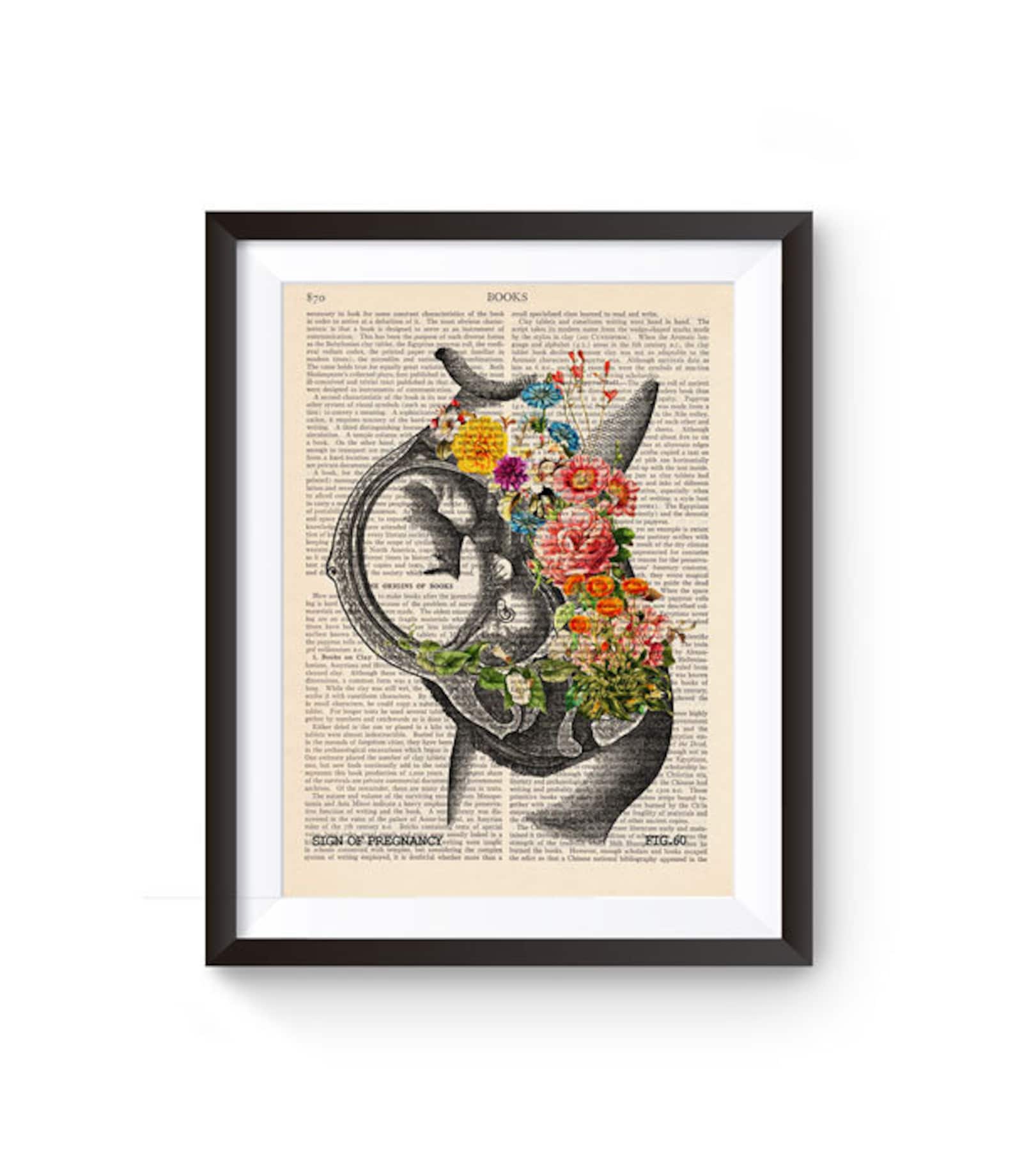 Pregnancy Print Baby Art Expecting Mom Gift Fetus in Womb - Etsy