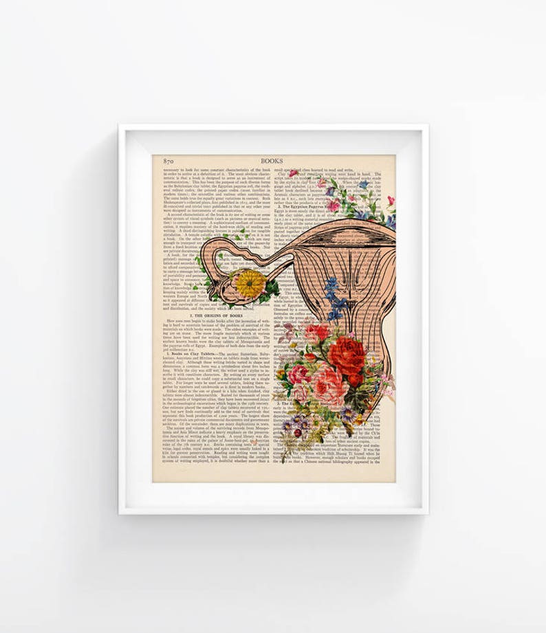 Uterus Print, Medical Art, Reproductive System Illustration, Obgyn Gift ...
